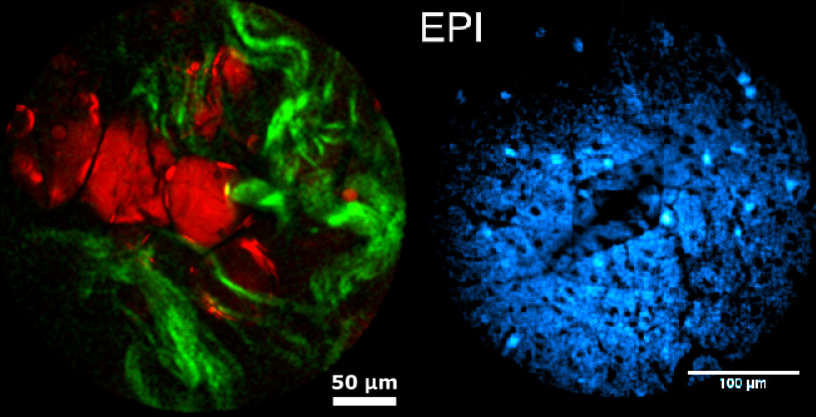 Microendoscopes: The holy grail of medicine | Electro Optics